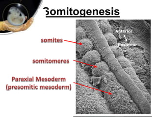Paraxial and intermediate mesoderm | PPTX