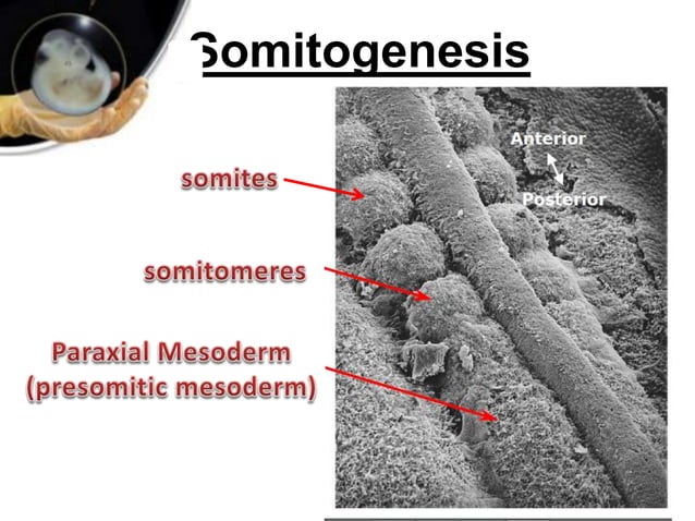 Paraxial and intermediate mesoderm | PPTX | Bone and Joint Conditions ...
