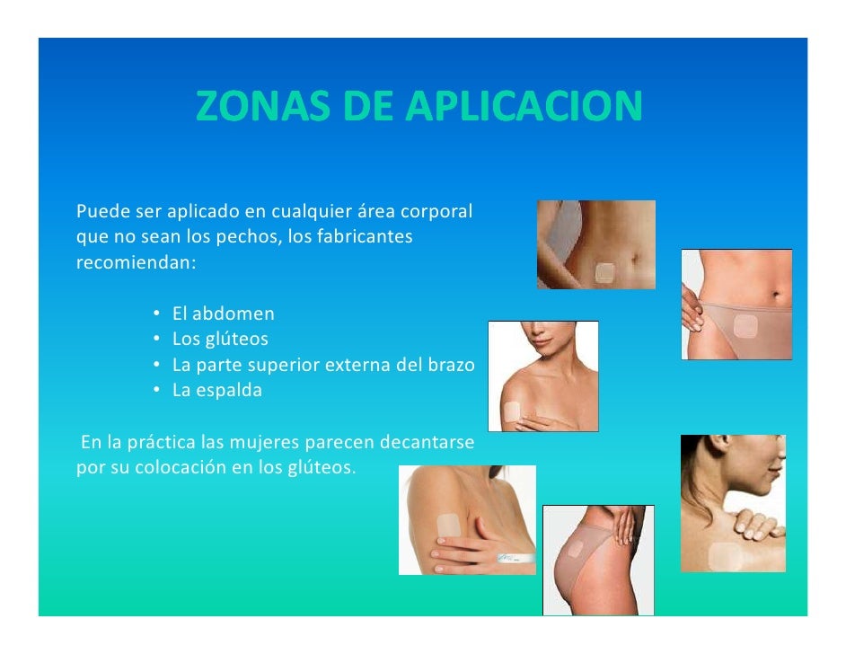 Avances en Métodos Anticonceptivos Autoadministrados (Parches anticon…