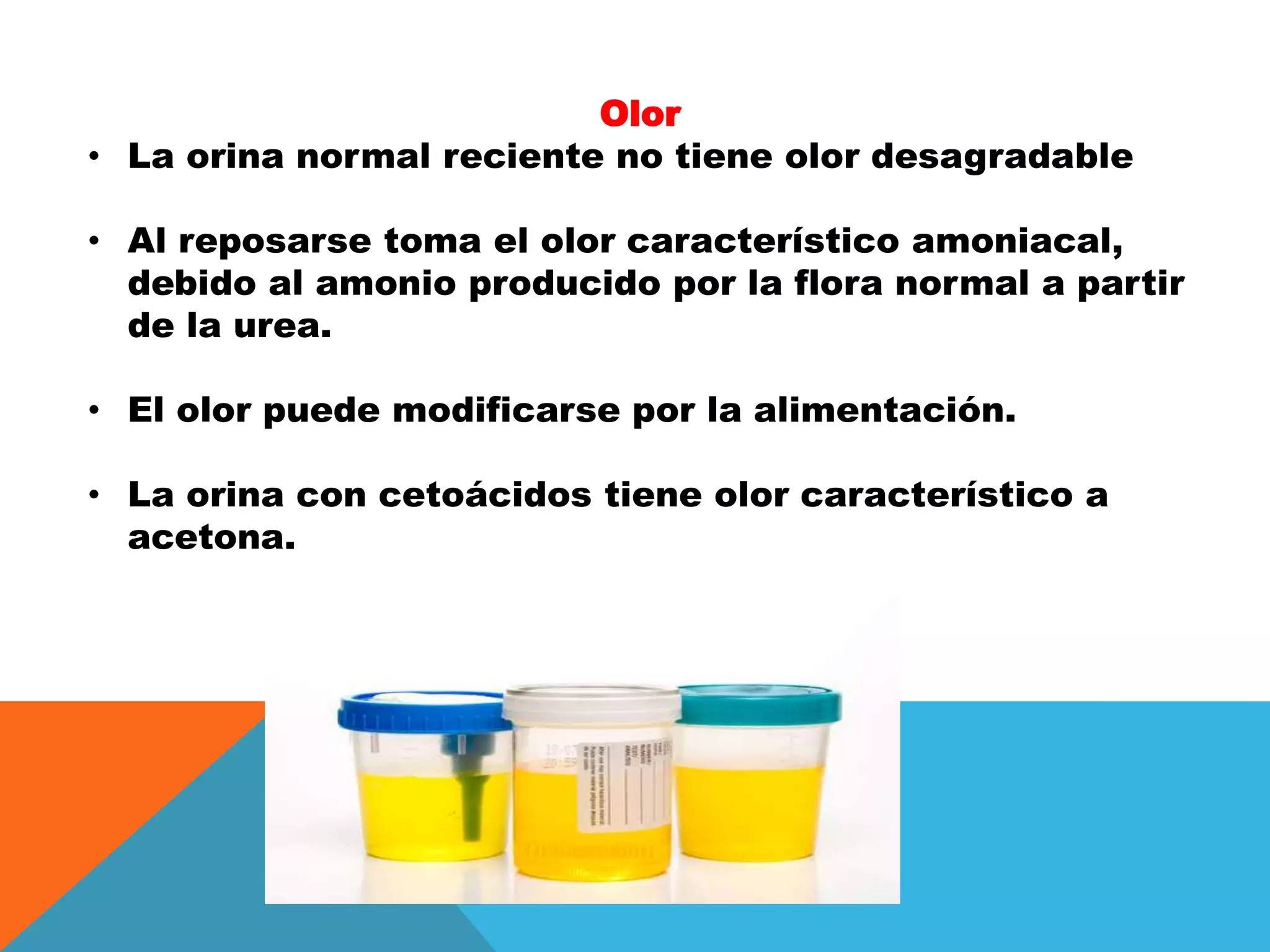 Parcial de orina | PPTX