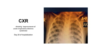 Paediatric Acute Respiratory Distress | PPTX