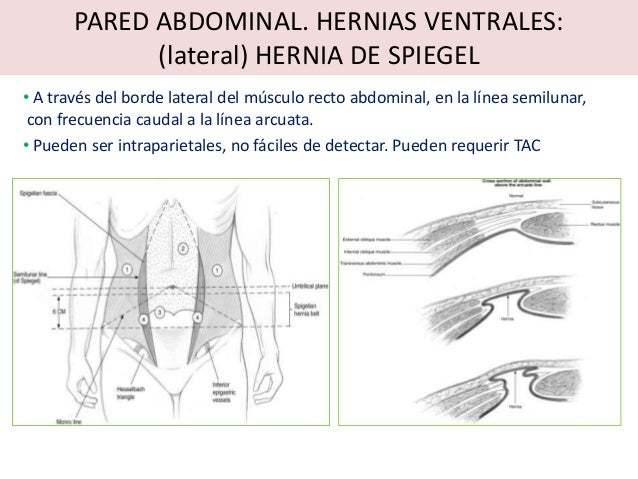 Pared abdominal