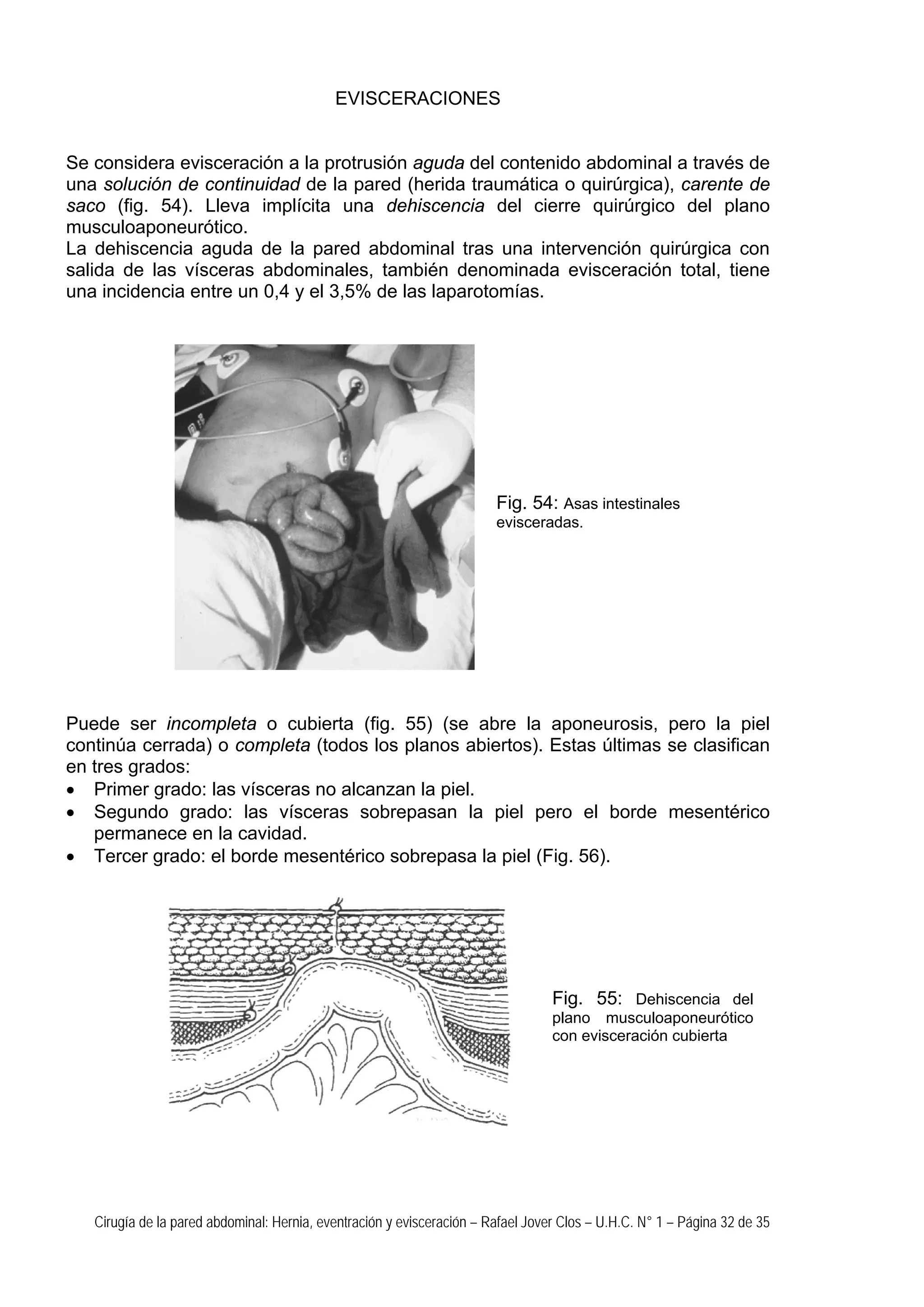 Cirugía de la pared abdominal: Hernia, eventración y evisceración | PDF ...