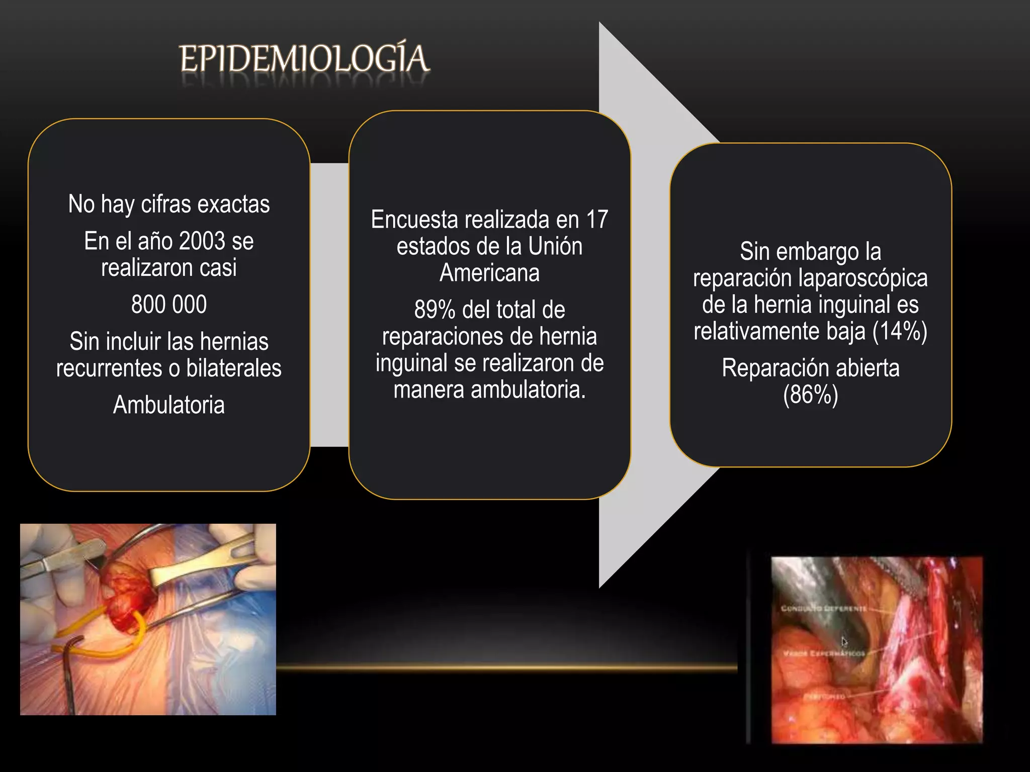 Pared abdominal: Hernias de la Región Inguino-crural | PPT