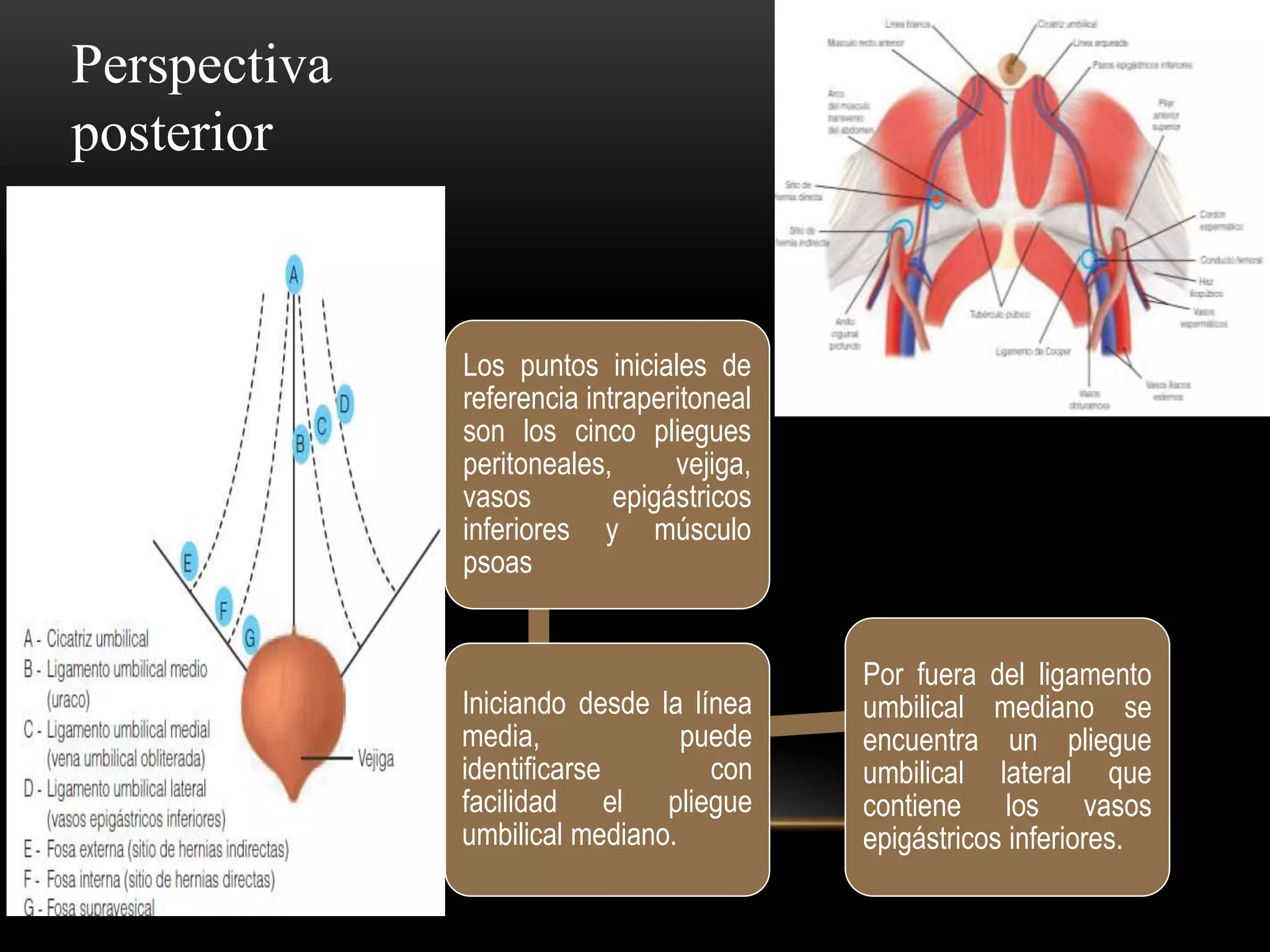Pared abdominal: Hernias de la Región Inguino-crural | PPT