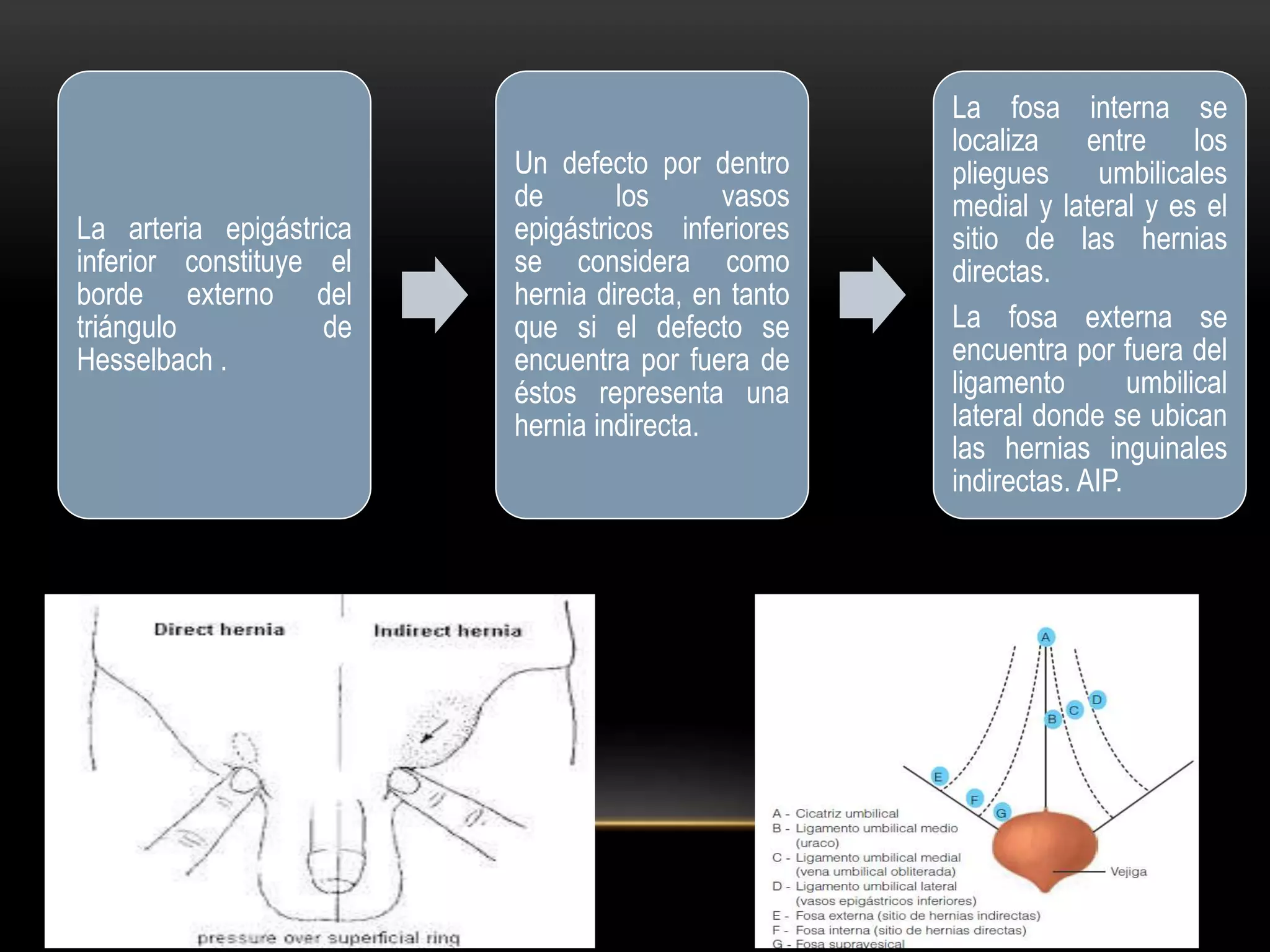 Pared abdominal: Hernias de la Región Inguino-crural | PPT