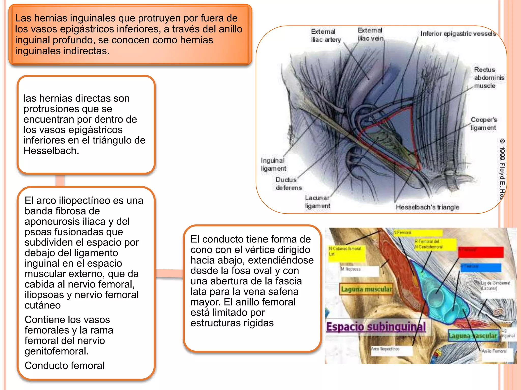 Pared abdominal: Hernias region inguino-crural | PPTX