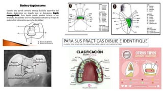 PAREDES Y ANGULOS DE LAS CAVIDADES DENTALES(1).pptx