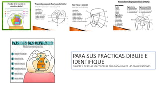 PAREDES Y ANGULOS DE LAS CAVIDADES DENTALES(1).pptx