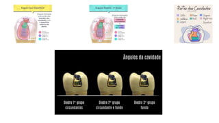 PAREDES Y ANGULOS DE LAS CAVIDADES DENTALES(1).pptx