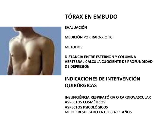 Pared torácica pleura y mesotelioma