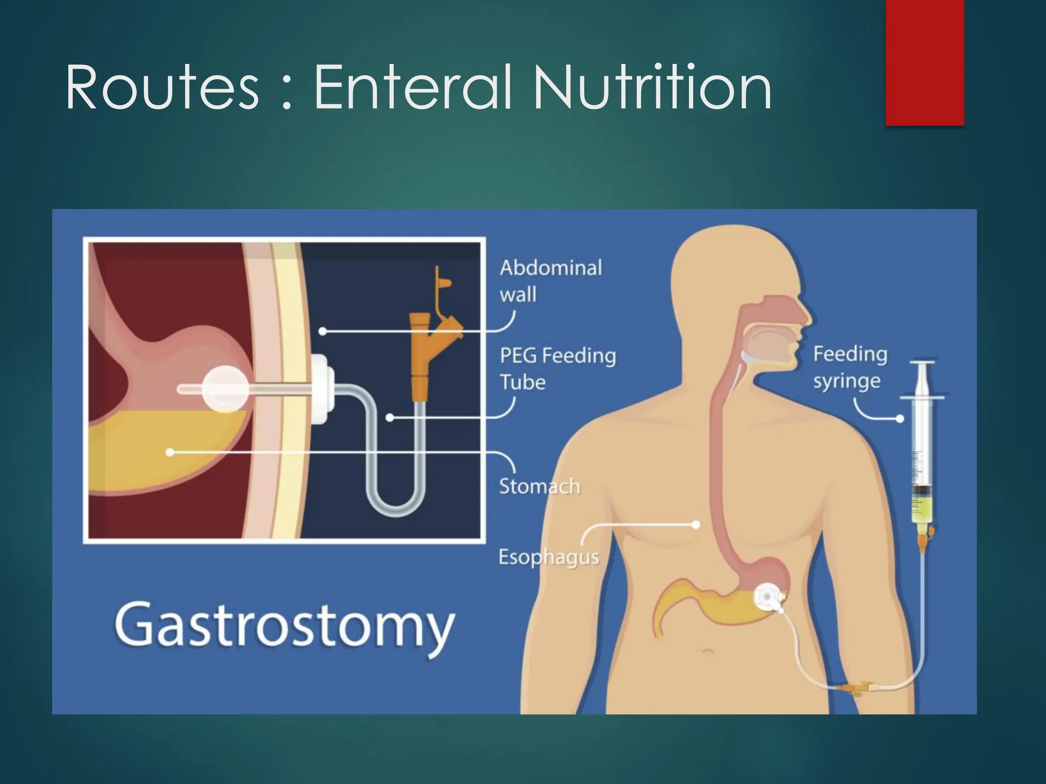 Parental and enteral nutrition Final.pdf