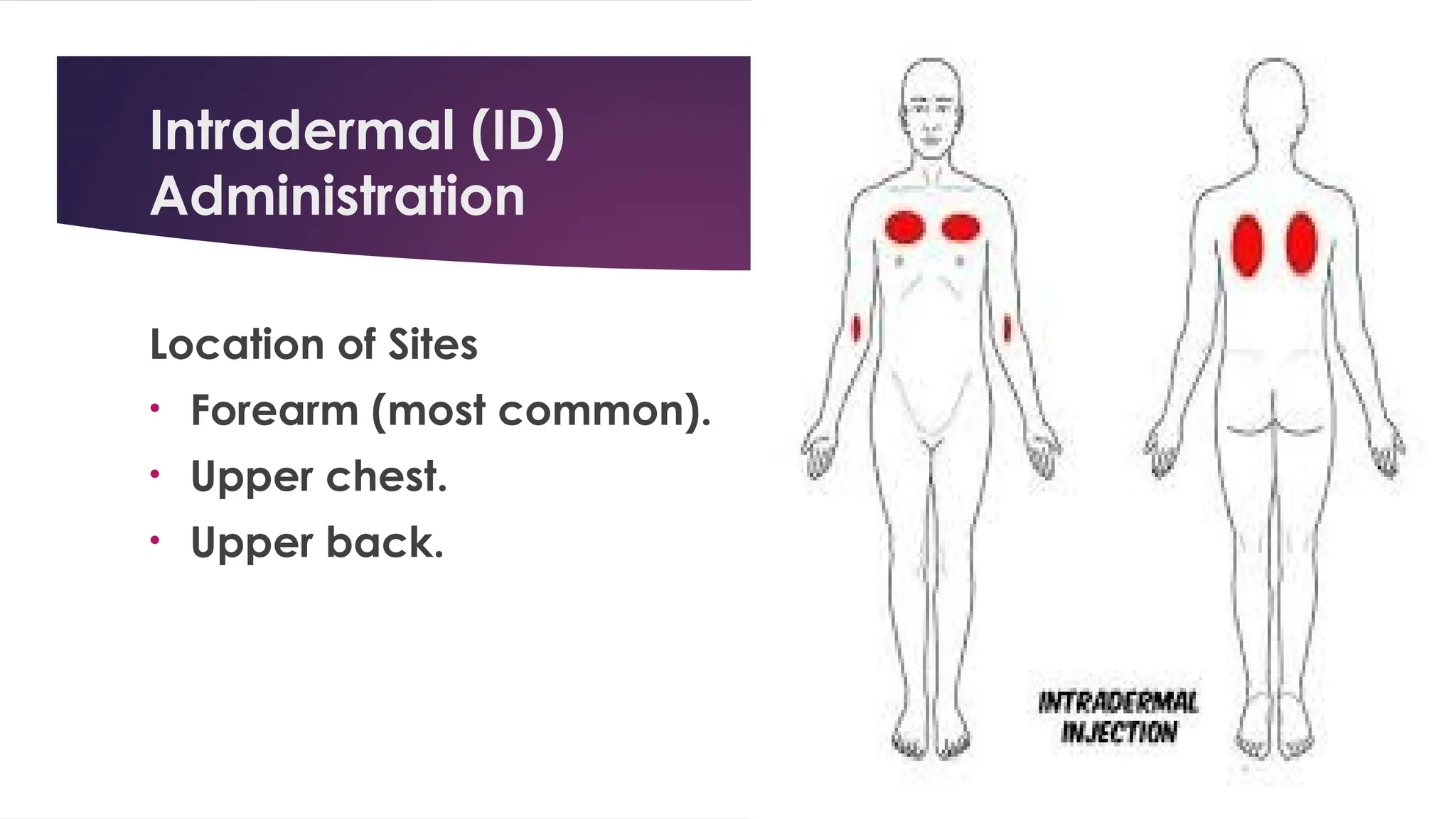 Parenteral Routes of Drug Administration: IM, IV, ID, and SC Injections ...