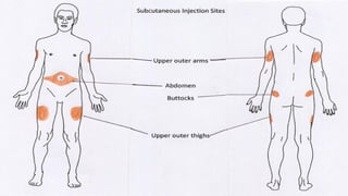Parenteral Routes of Drug Administration: IM, IV, ID, and SC Injections ...