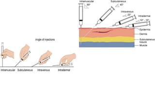 Parenteral Routes of Drug Administration: IM, IV, ID, and SC Injections ...