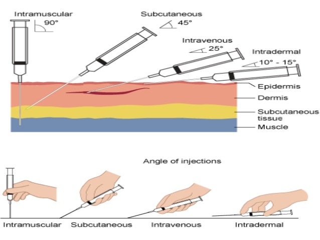PARENTERAL ROUTES OF DRUG ADMINISTRATION
