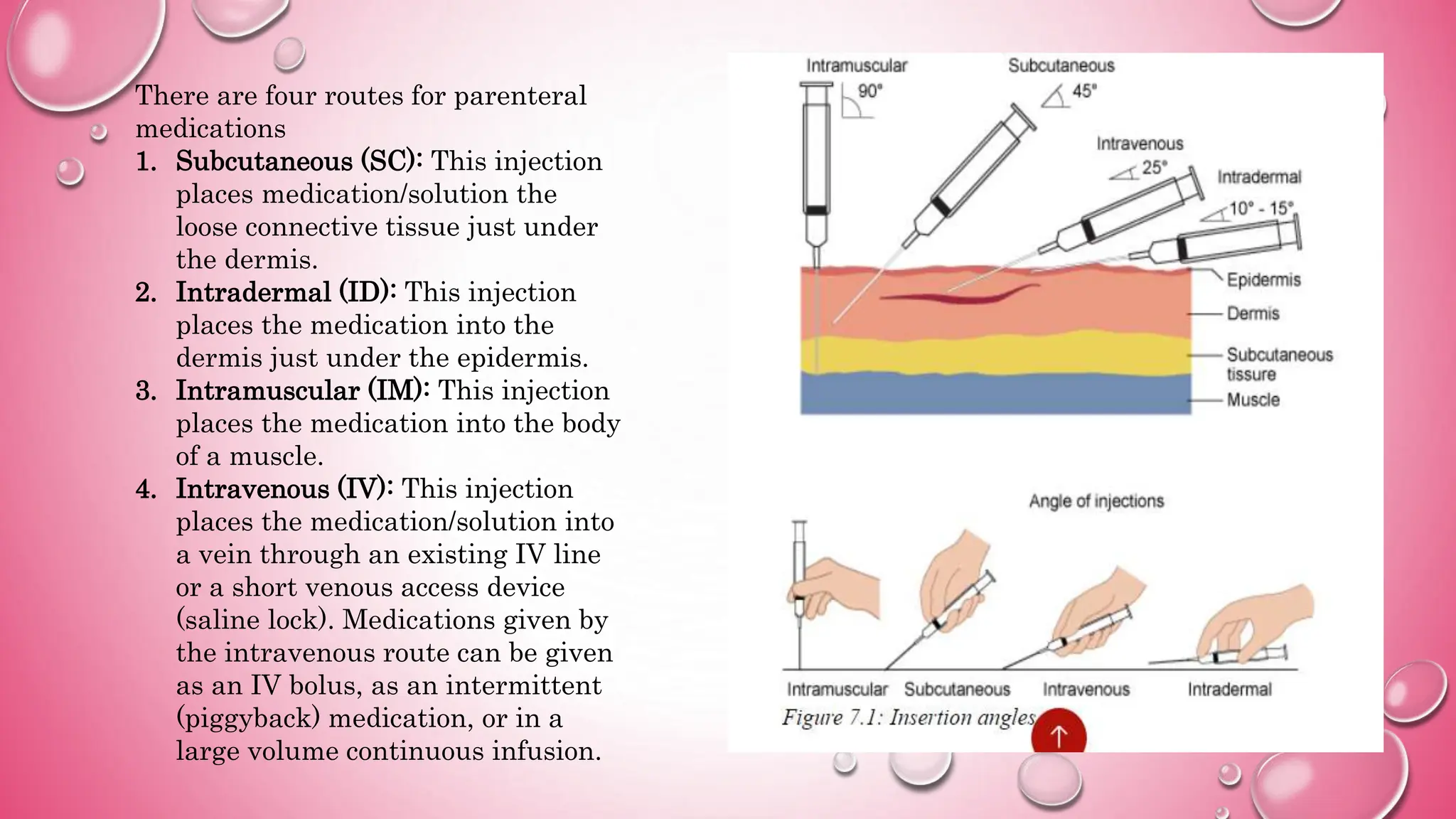 fundamentals of nursing- Parenteral adm.pptx
