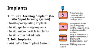 Parenteral controlled drug delivery.pptx