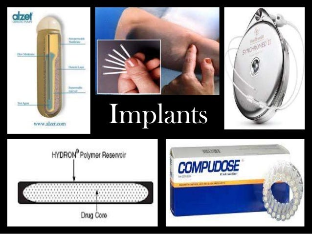 Parenteral controlled release drug delivery system - by varsha phirke