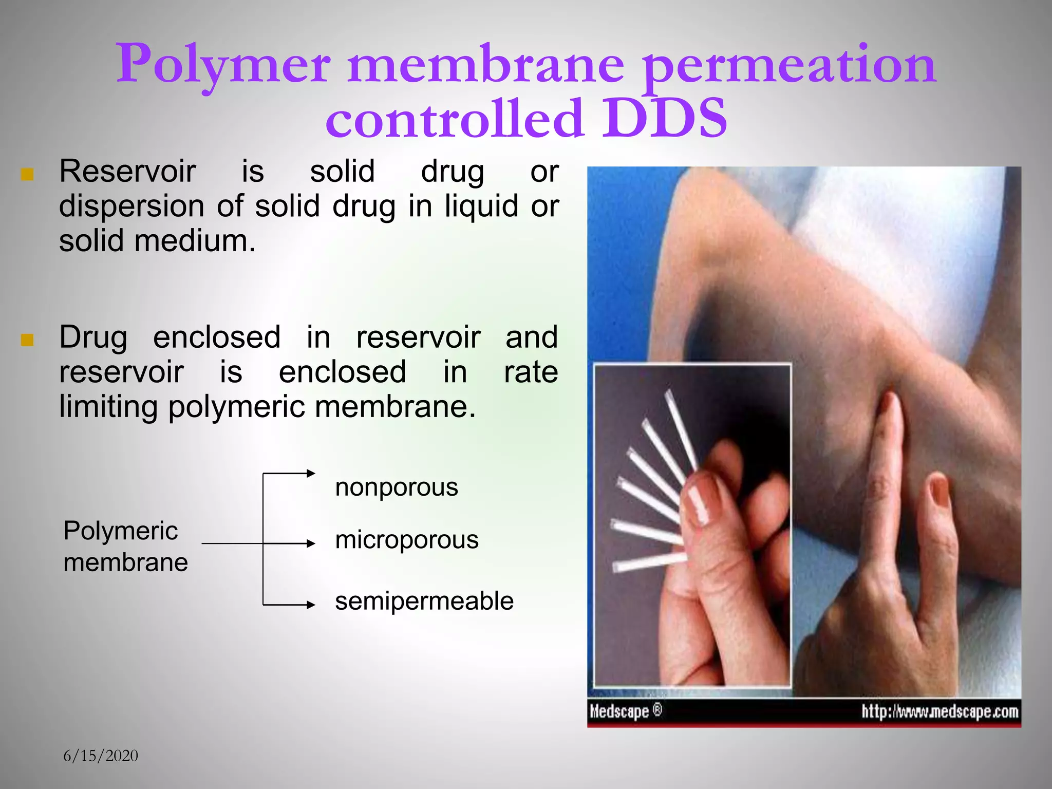 Parenteral controlled release drug delivery systems | PPT
