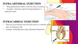 Types of Parenteral Formulation | PPTX