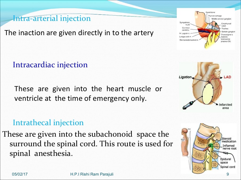 Parenteral