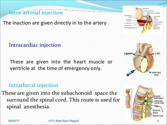 Parenteral Products