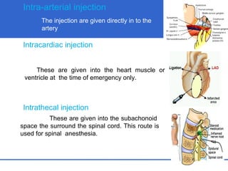 Parentral route and formulation | PPT