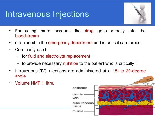 Intravenous Injection Angle
