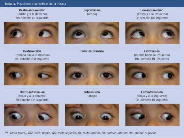 Exploración de Pares Craneales