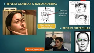 Pares craneales | PPT