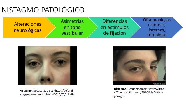 Exploración par III, IV y IV
