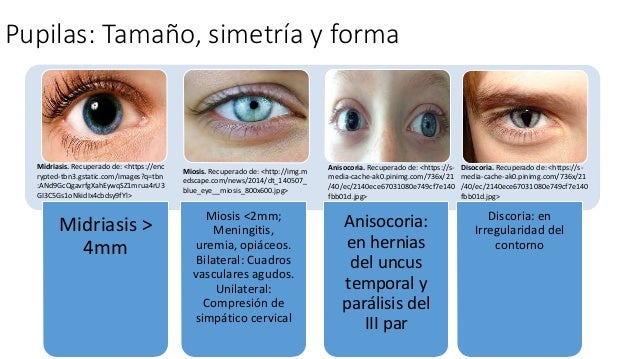 Miosis Y Midriasis