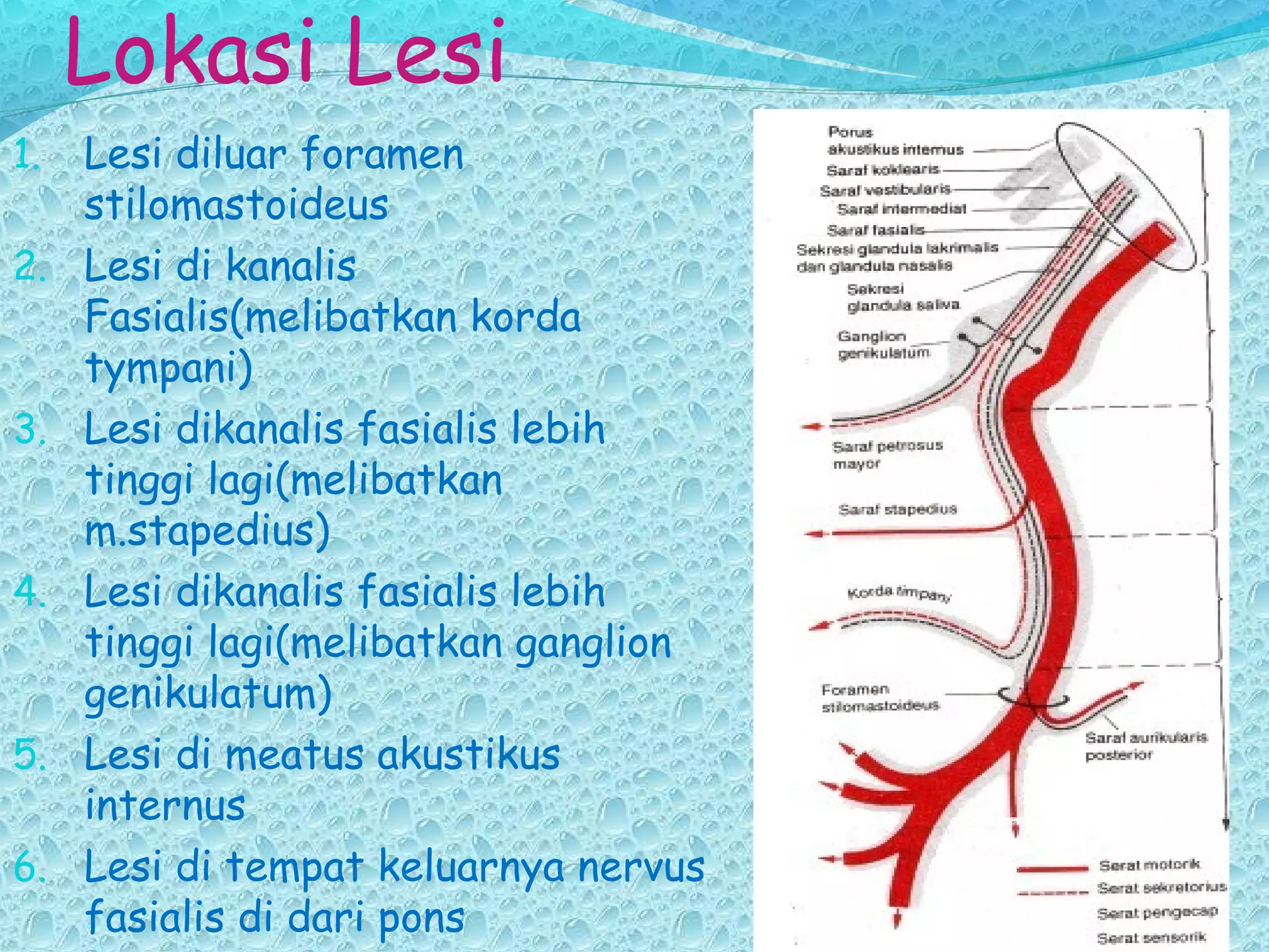 Parese nervus fasialis | PPT