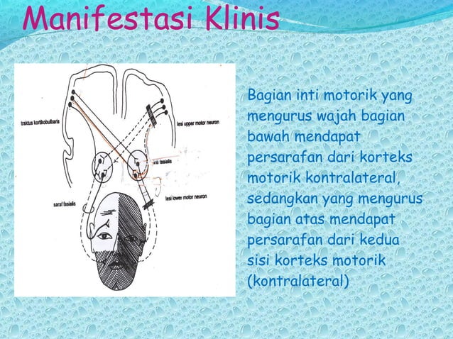 Parese nervus fasialis | PPT