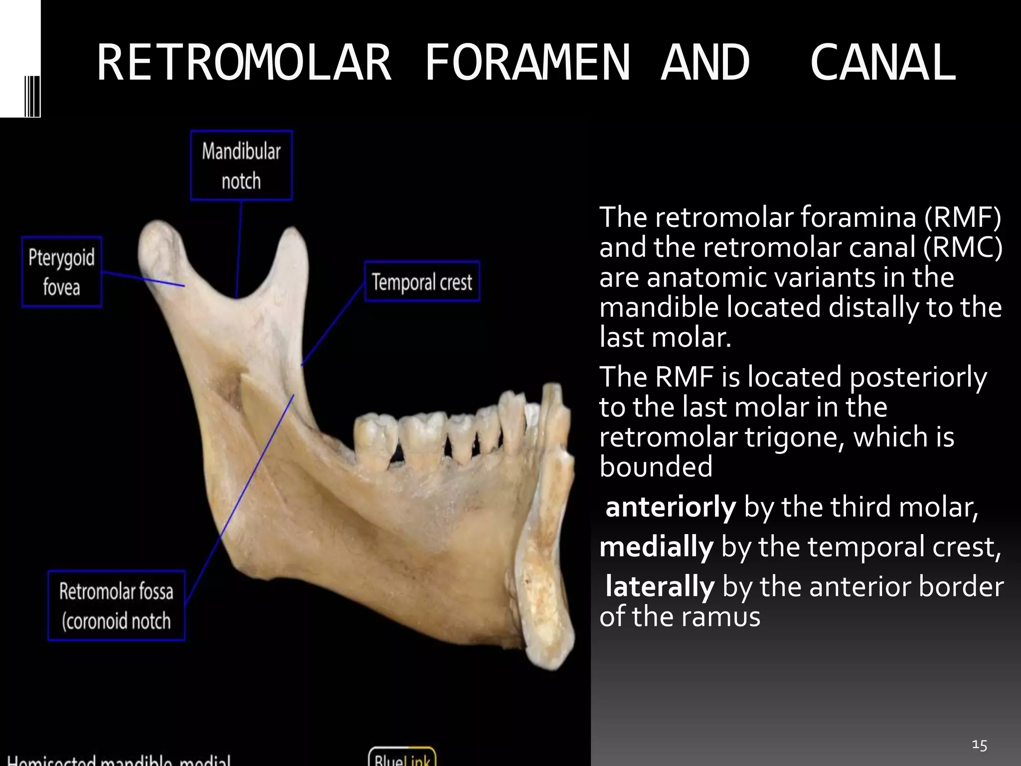 SURGICAL EXTRACTION OF MANDIBULAR THIRD MOLAR | PPTX