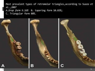 SURGICAL EXTRACTION OF MANDIBULAR THIRD MOLAR | PPTX