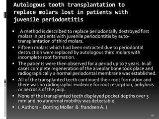 SURGICAL EXTRACTION OF MANDIBULAR THIRD MOLAR | PPTX