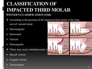 SURGICAL EXTRACTION OF MANDIBULAR THIRD MOLAR | PPT
