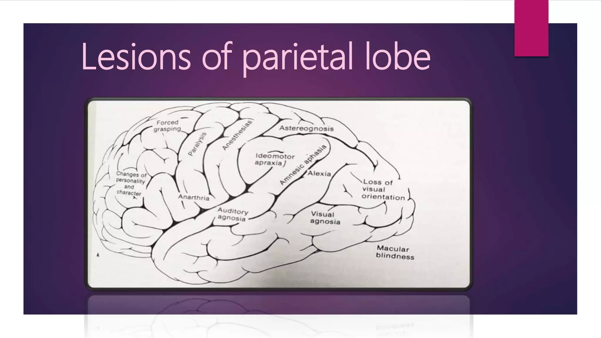 Parietal lobe it's lesions and orbital nerve pathway and it's lesions | PPTX
