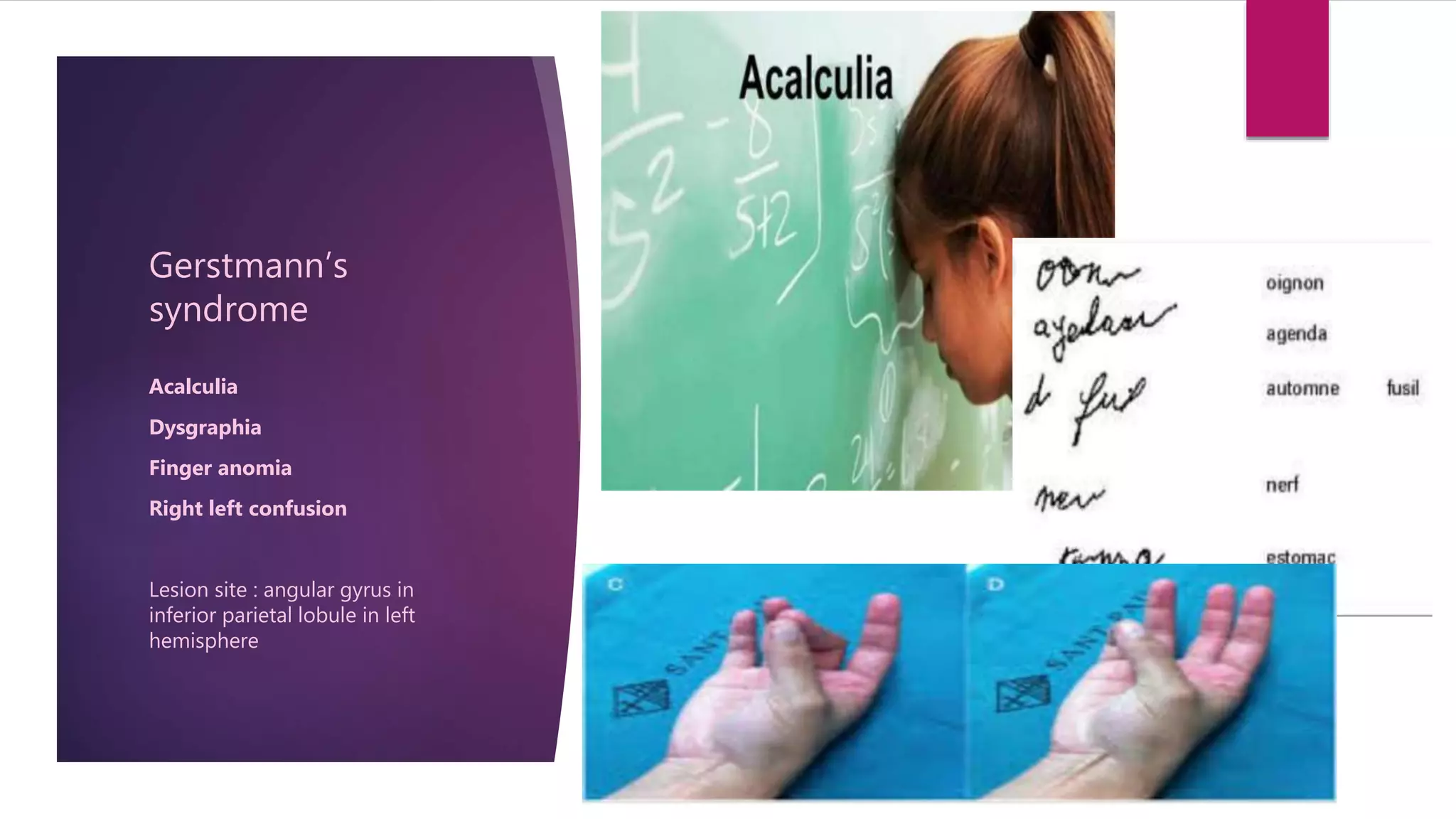 Parietal lobe it's lesions and orbital nerve pathway and it's lesions ...