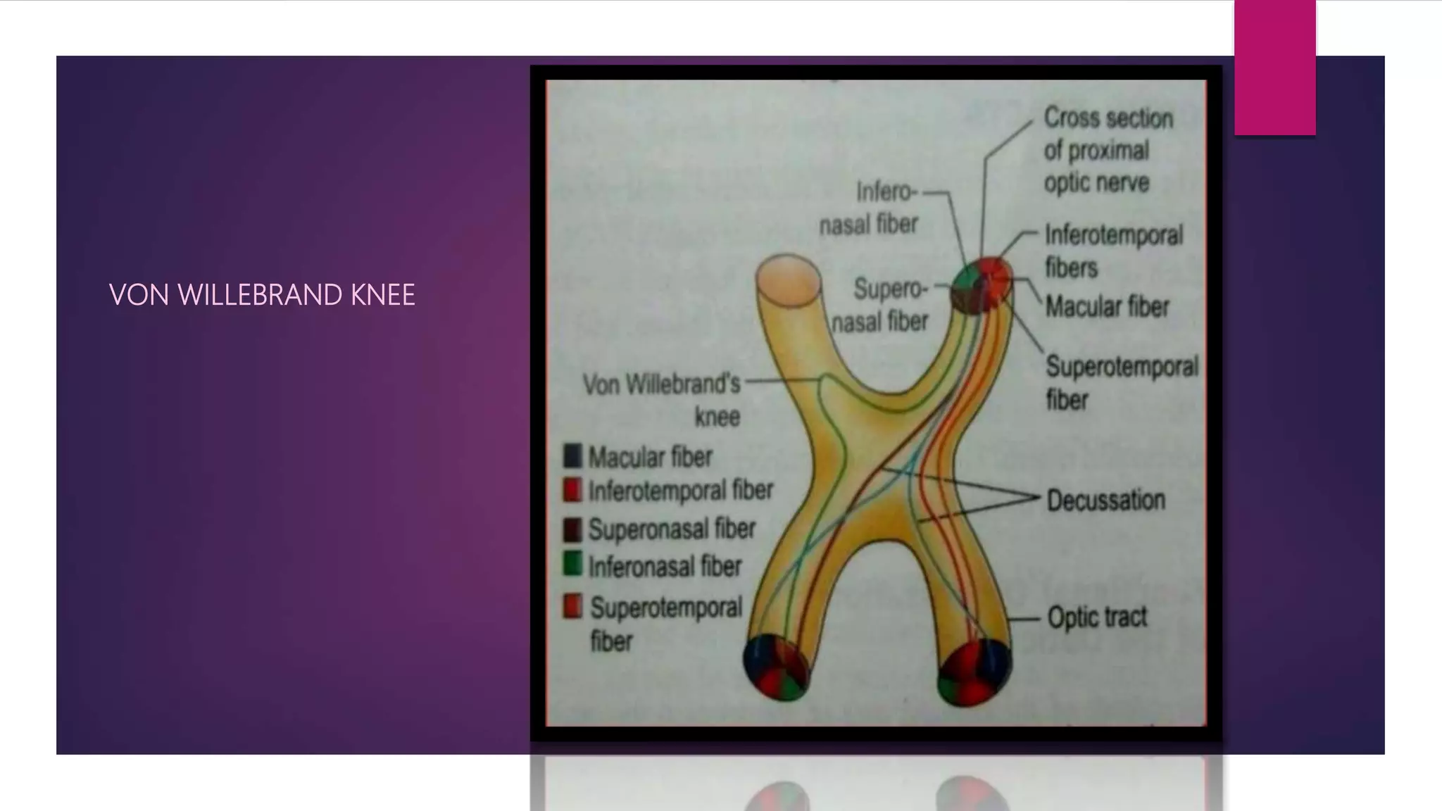 Parietal lobe it's lesions and orbital nerve pathway and it's lesions ...