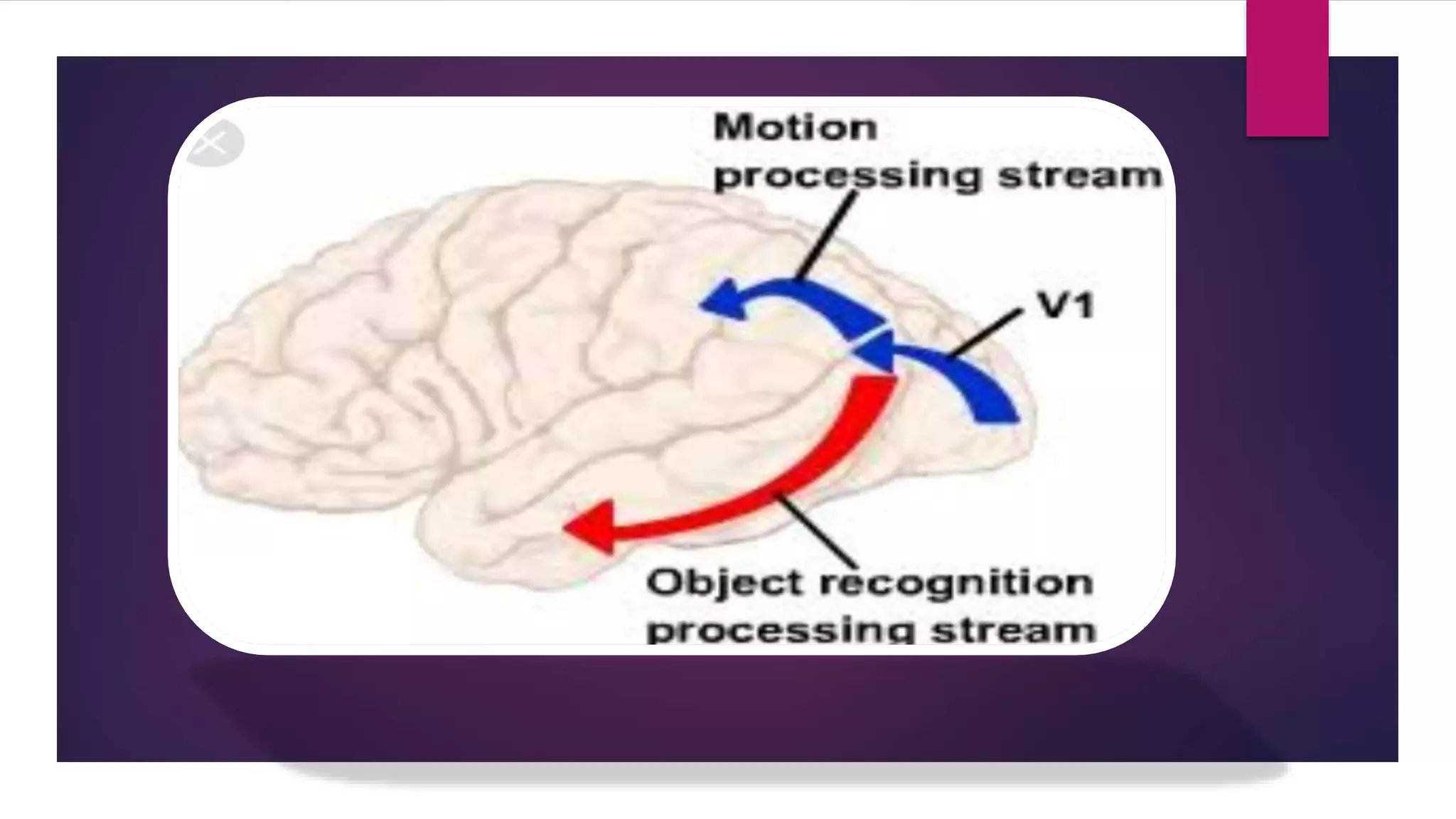 Parietal lobe it's lesions and orbital nerve pathway and it's lesions ...
