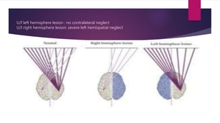 Parietal lobe it's lesions and orbital nerve pathway and it's lesions ...