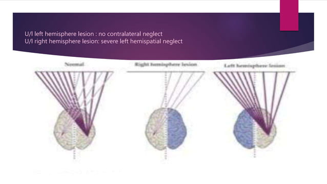 Parietal lobe it's lesions and orbital nerve pathway and it's lesions ...