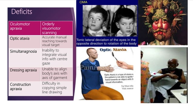 Parietal lobe it's lesions and orbital nerve pathway and it's lesions ...