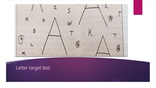 Parietal lobe it's lesions and orbital nerve pathway and it's lesions ...