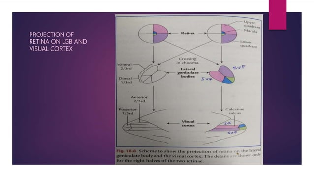 Parietal lobe it's lesions and orbital nerve pathway and it's lesions ...