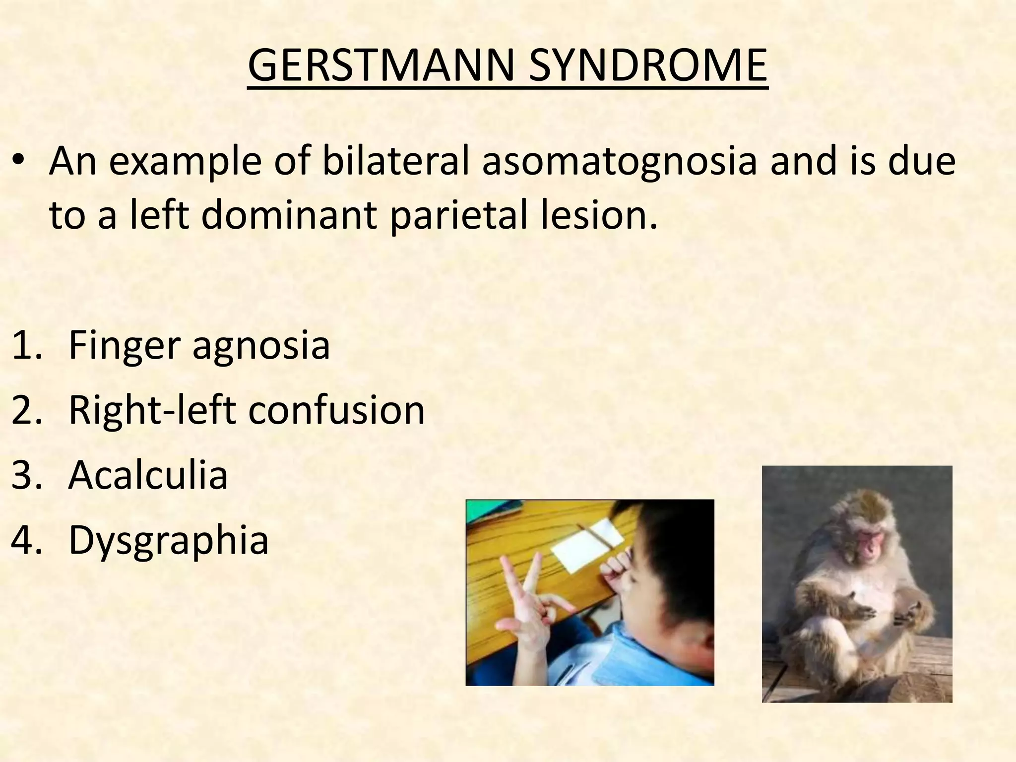 Parietal lobe and its functions | PPTX