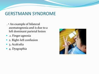 Parietal & occipital lobes | PPT